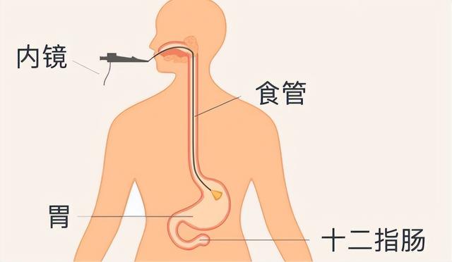 After a gastroscopy, how can I see if there is any problem with the ...