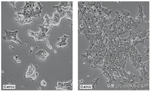HEK-293 cell culture characteristics and precautions - iNEWS