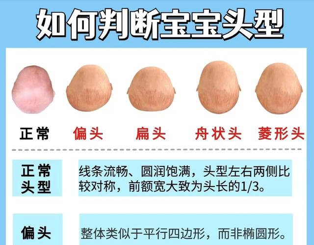 How should the baby's head shape be corrected?How to choose a baby ...