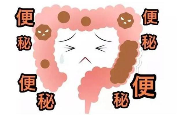 The person with the longest constipation in the world has an intestinal ...