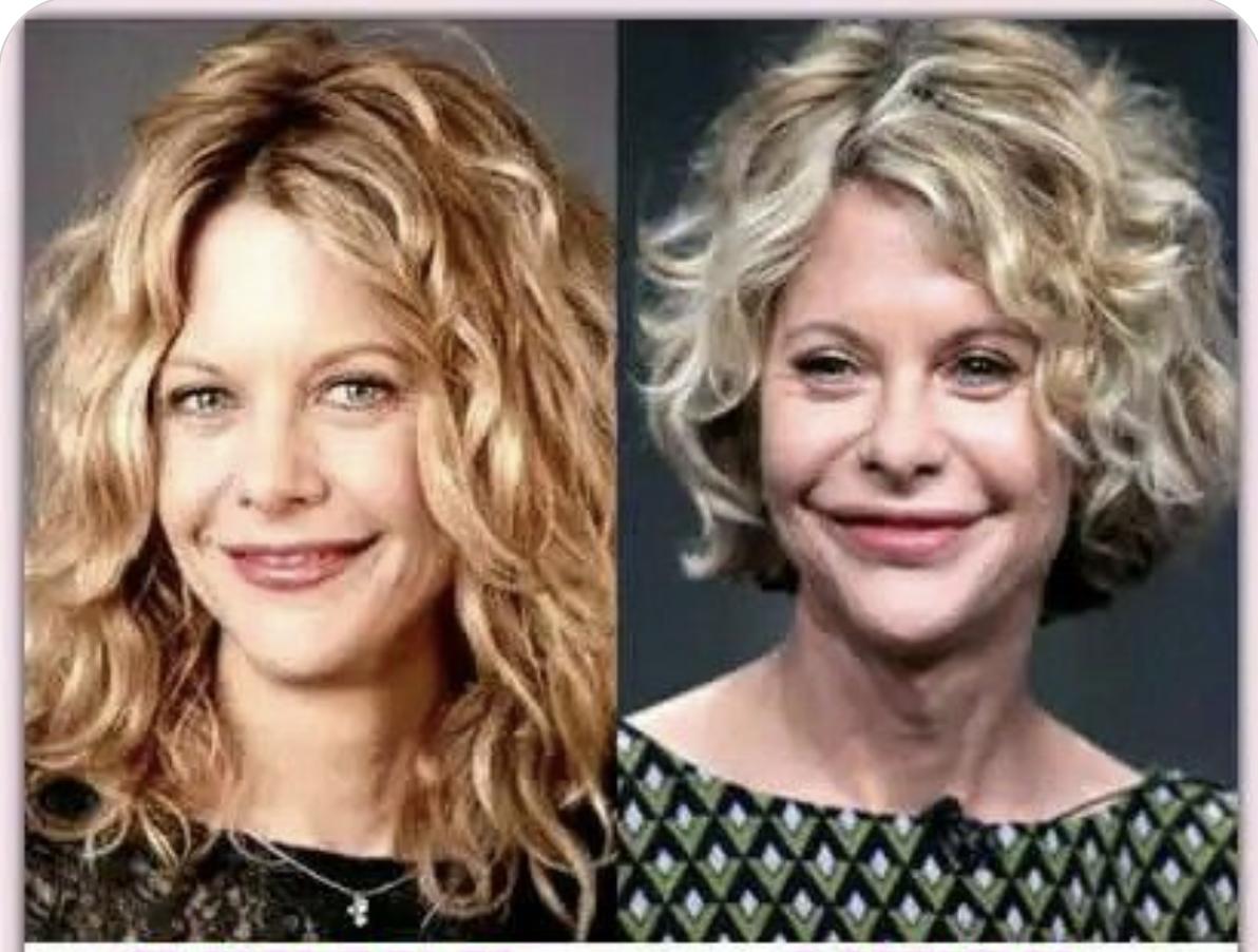 10 unrecognizable stars after plastic surgery (good and bad) - iNEWS