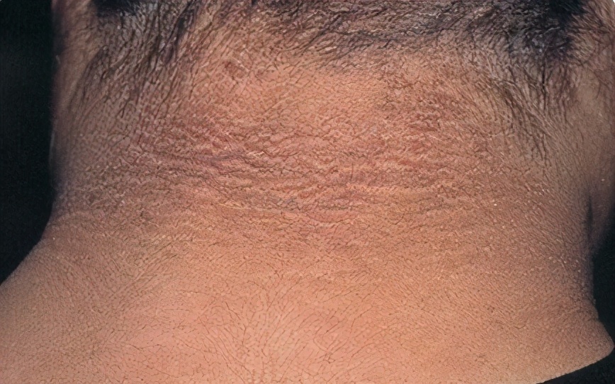 What do doctors often mean by insulin resistance? Why does insulin ...