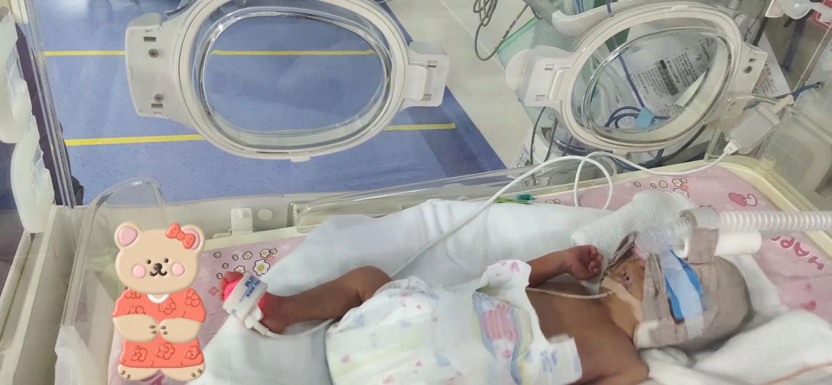 29 weeks plus the growth of premature babies - iNEWS