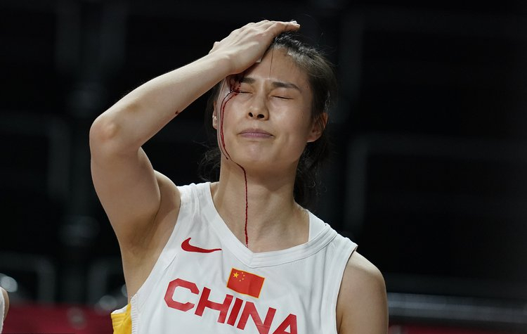 Wang Siyu is blood-stained and angrily cuts 20+5+3 in the arena!Women's ...