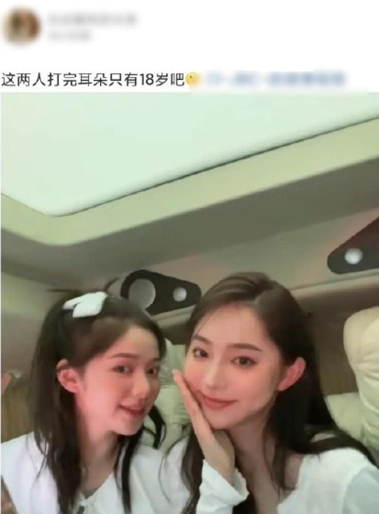 "Elf Ears" became popular in plastic surgery circle!Netizen: My windy ...