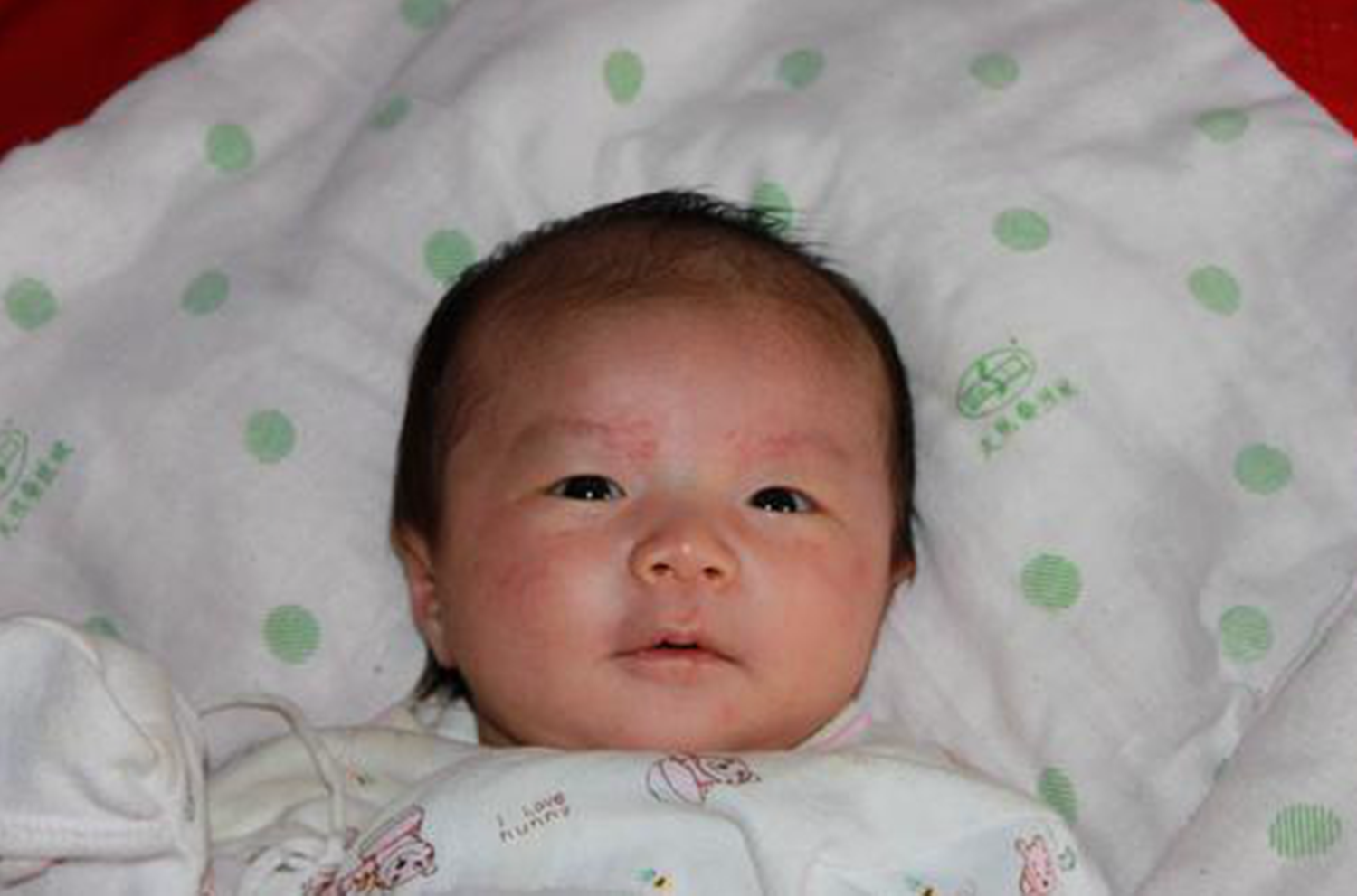 The novice mother pulls out the black thorns on the baby's body ...