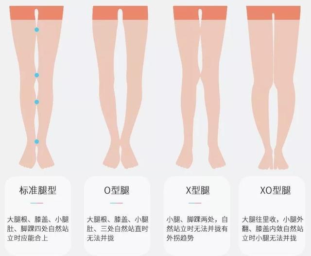 What kind of legs do you have for girls? - iMedia