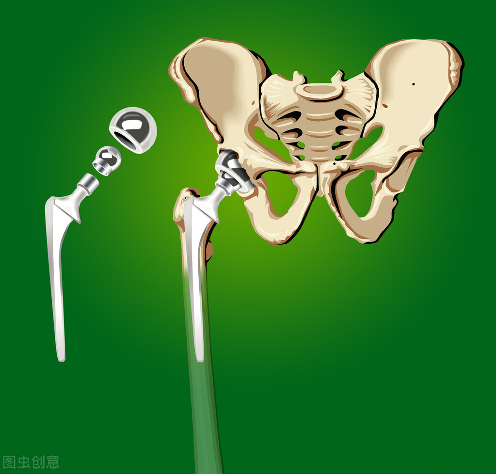 There is a disease in the hip joint, and the movement is blocked!The ...