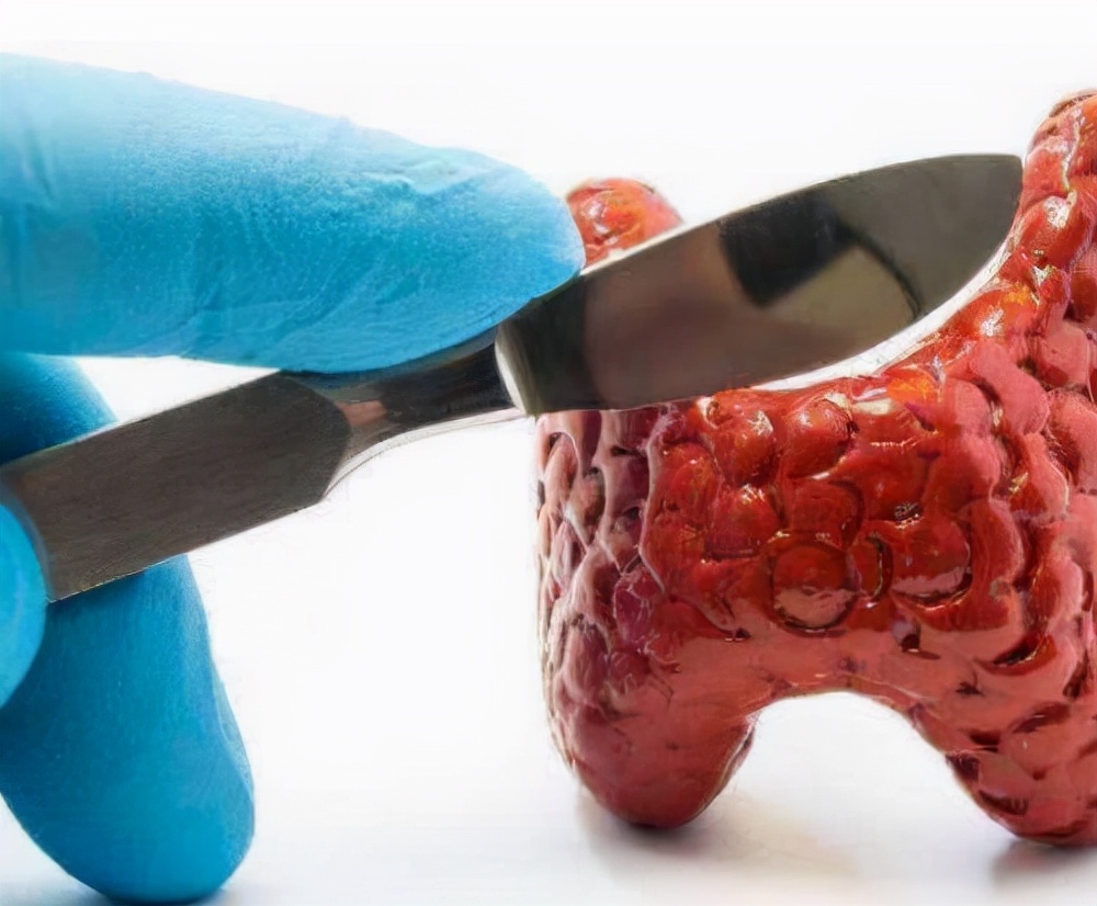 Is it better to choose minimally invasive surgery for thyroid surgery ...