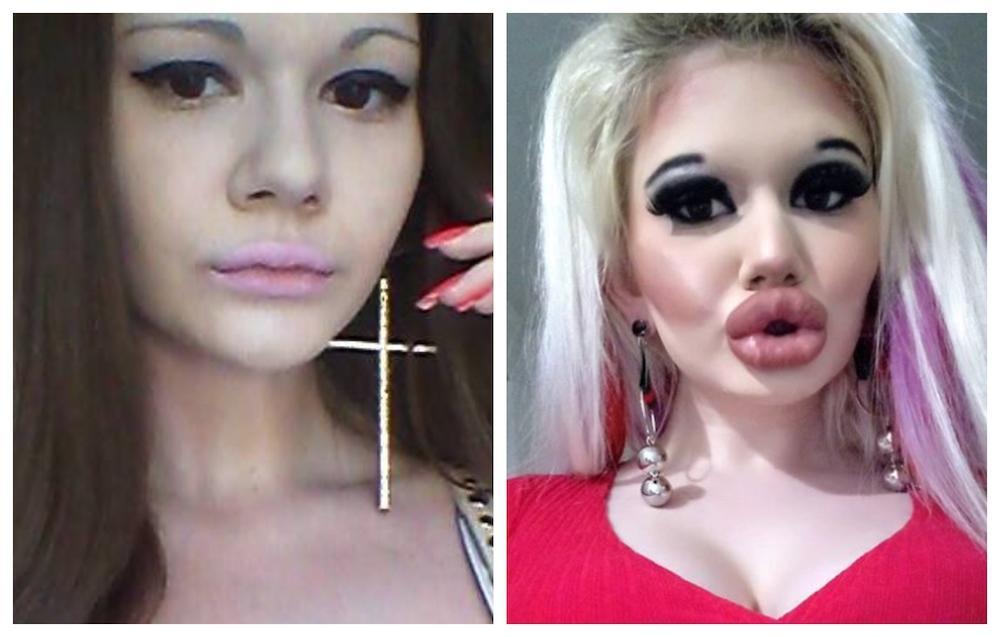 Bulgaria's 23-year-old "Realistic Barbie" has the world's biggest lips ...