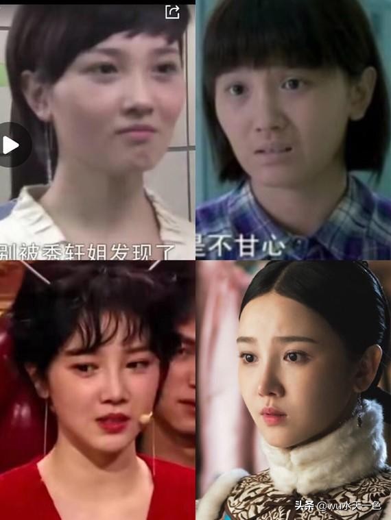 After ten plastic surgery, she became a Disney princess, but she lost ...