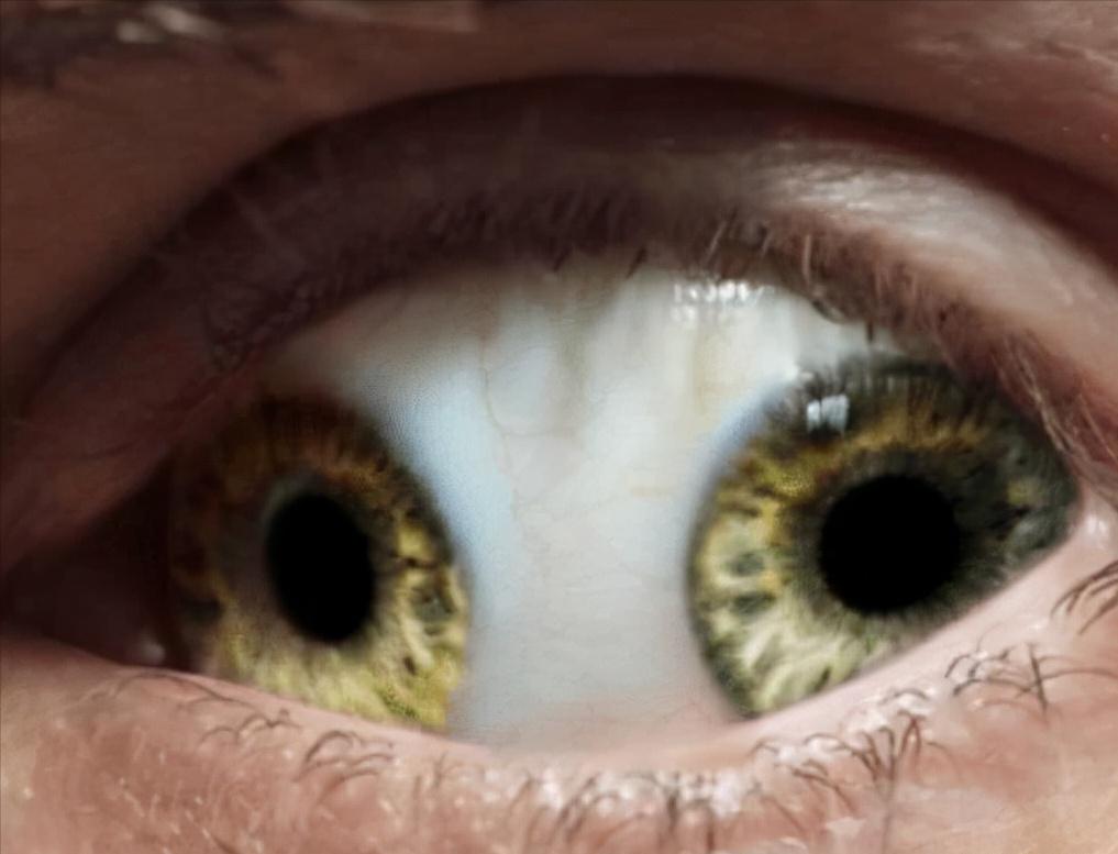 Is "twin pupil" special?The 8 people who owned it in history were ...