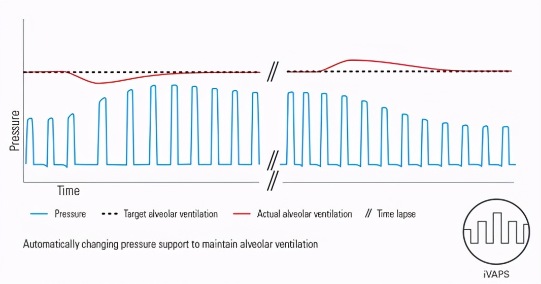 家用慢阻肺呼吸機ST、AVAPS和iVApS 之間有啥區別？ - 資訊咖