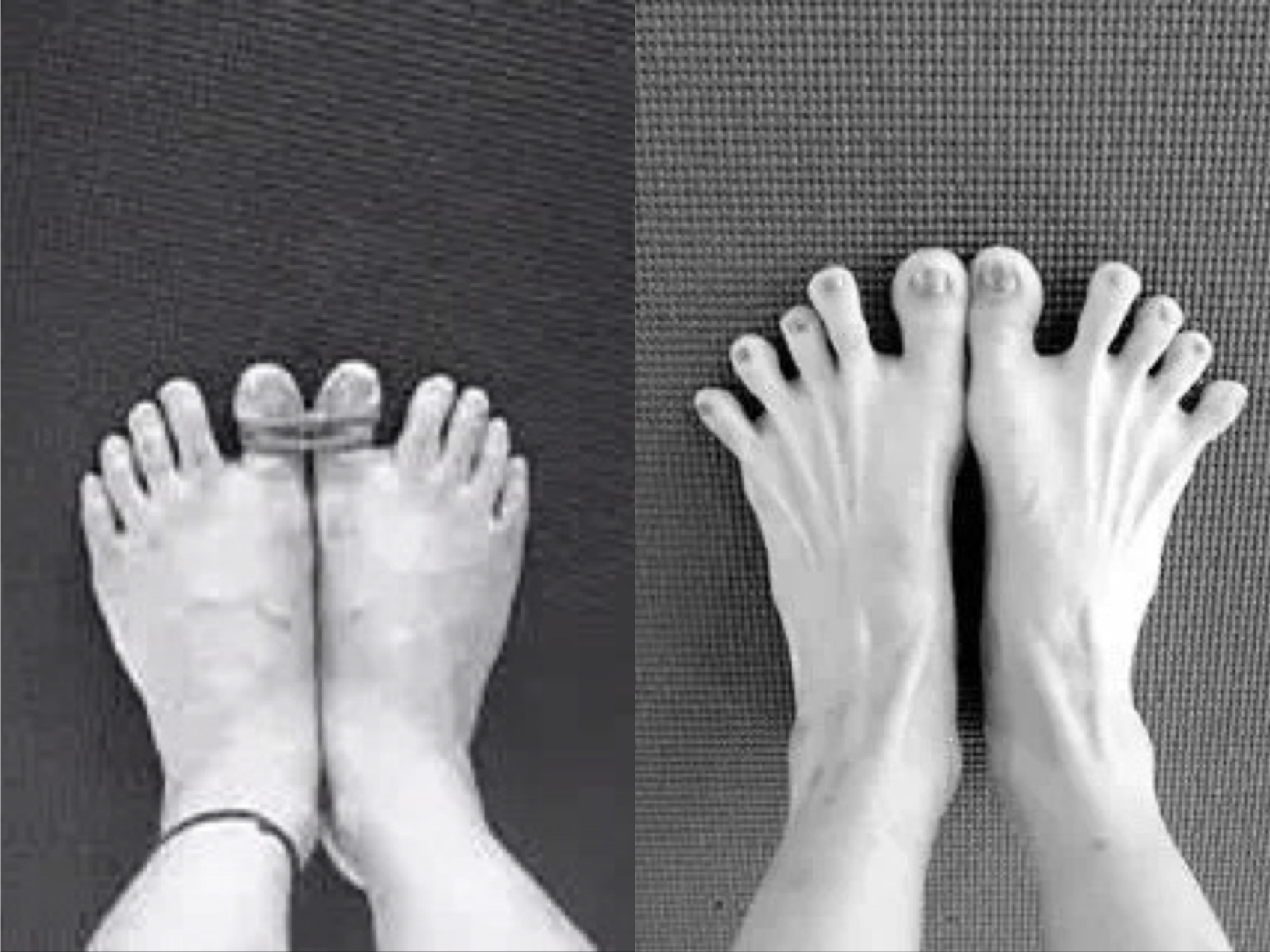 In yoga practice, how can the 5 toes be separated and flattened ...