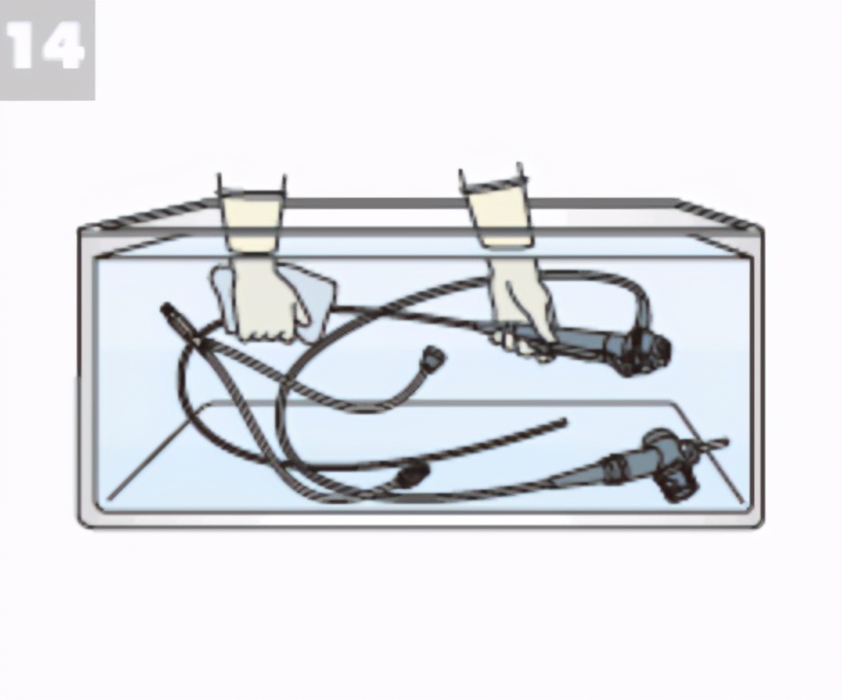 Bronchoscope cleaning guide (OLYMPUS) - iNEWS