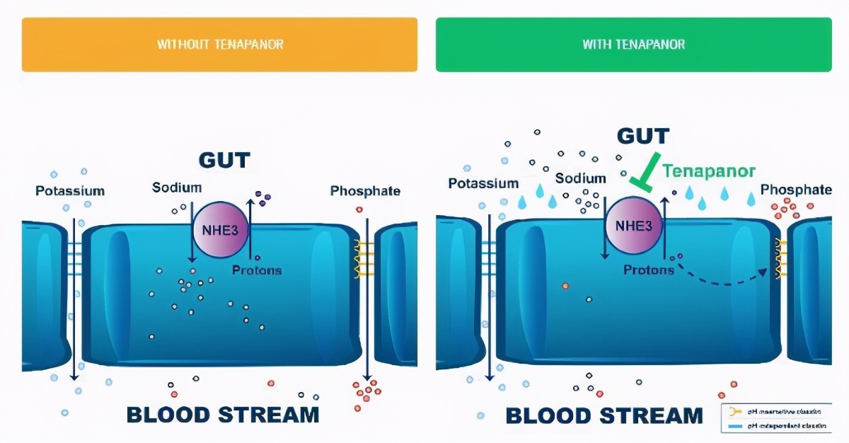 New drug for hyperphosphatemia: Effectively reduce serum phosphorus in ...