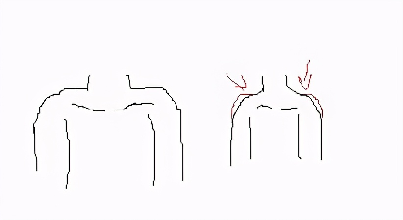 Want to improve the shoulder-slipping phenomenon?Refer to this set of ...