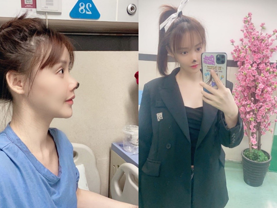 The actor Gao Liu appeared for the first time after a failed plastic ...