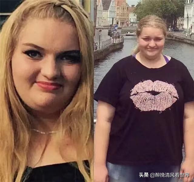 "Plastic surgery" to lose weight, she took two years for 300 kg, and ...
