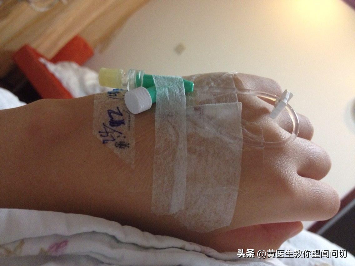 The effect of intravenous drip when the child has a fever may not be ...