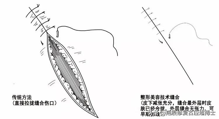 Say goodbye to the ugly centipede scar, you need to do this - iNEWS