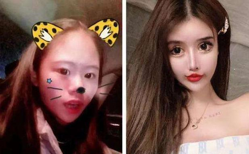 Net red Zhou Chuna spent 4 million plastic surgery!After five years of ...