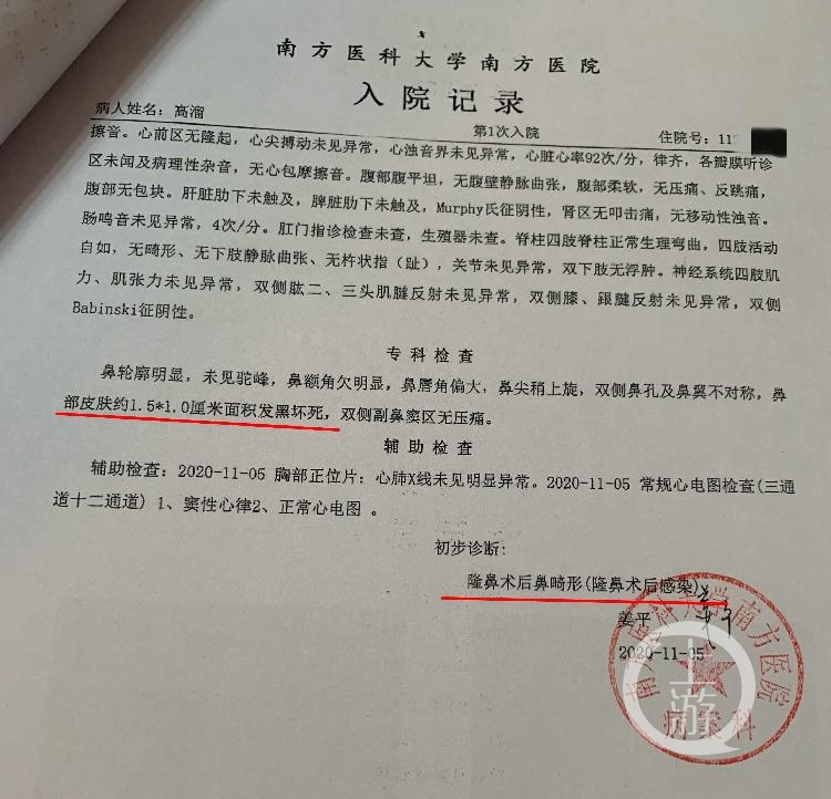 Actress Gao Liu exposes that nasal tip necrosis caused by plastic ...