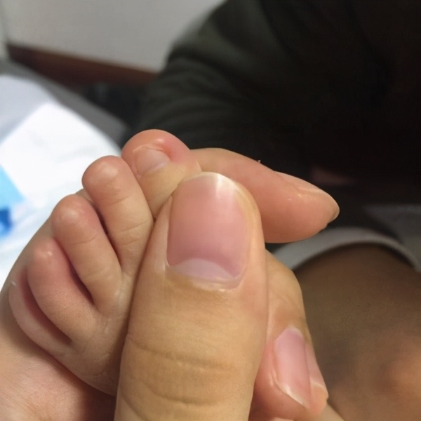 "Long toe baby" became popular, with toes longer than fingers, netizens ...