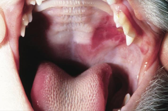 My cat has tongue ulcers, what should I do? - iNEWS