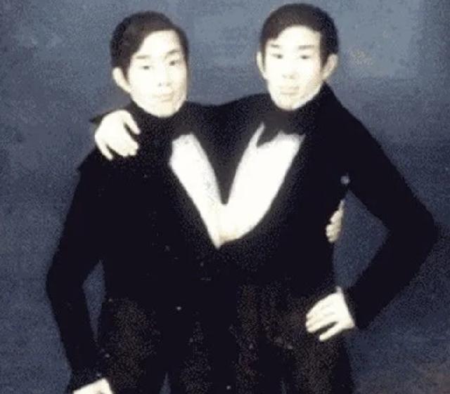 Thai Chinese Siamese brothers were born legendary, became rich, married ...