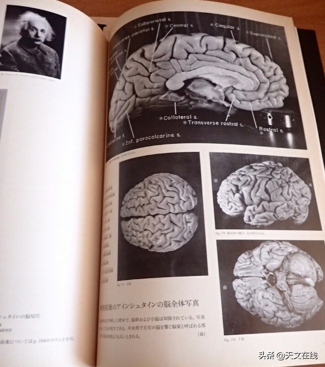 Deciphering Einstein's brain: What will we find after 240 slices? - iNEWS