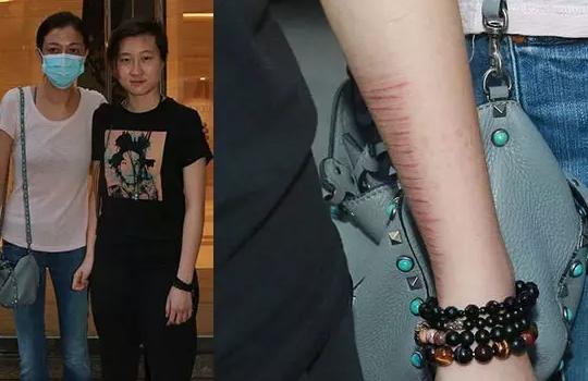 It was a mistake to be born, and Wu Zhuolin, the "Little Dragon Girl ...