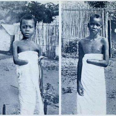 The King of Chopped Hands-He chopped over 10 million hands in Africa ...