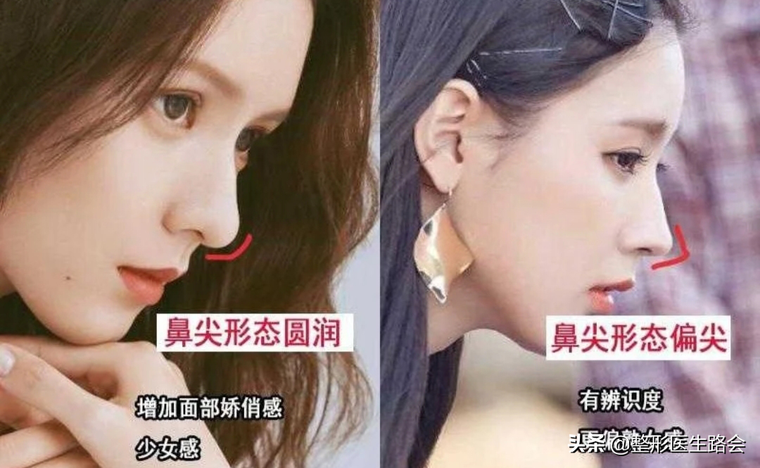 Straight nose, straight nose slightly curled, curled nose, slightly ...