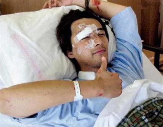 Fourteen years ago, he was disfigured by a car accident and sewed ...
