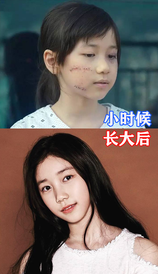 Can you still recognize the comparison of photos of child stars from ...