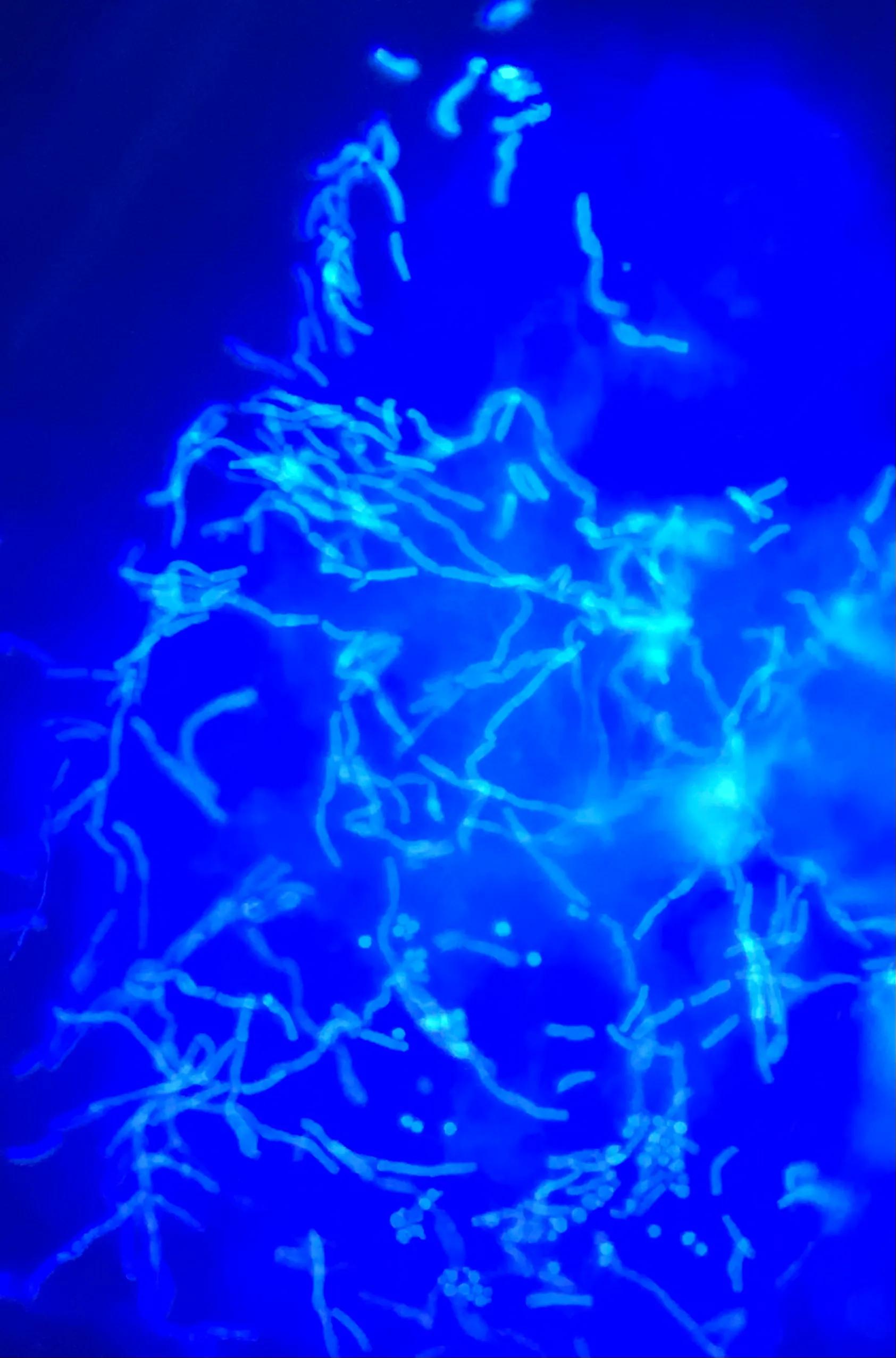 The doctor teaches you how to treat Hong Kong feet (beriberi, athlete's ...