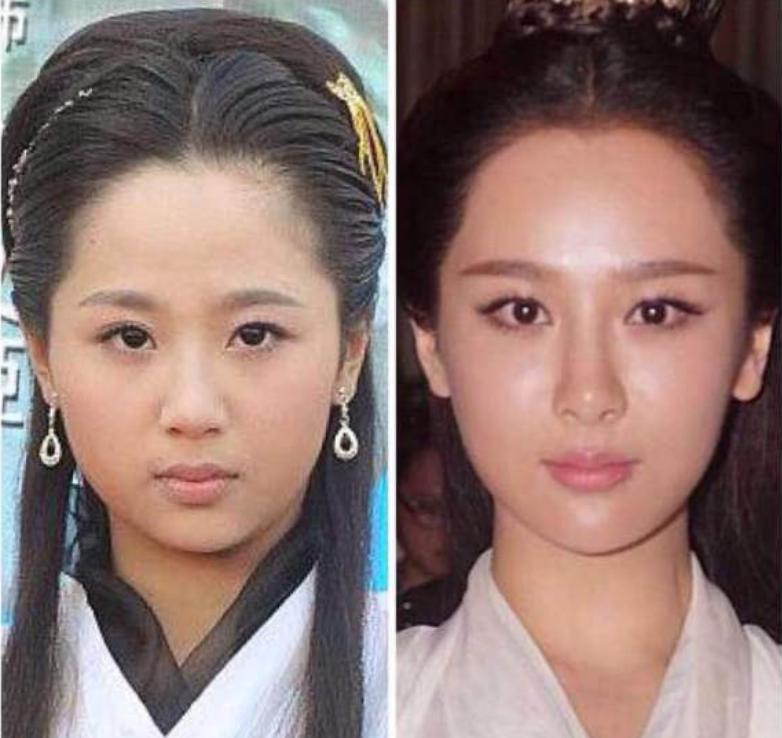 Plastic surgery has become disfigured, and the goddess has become an ...