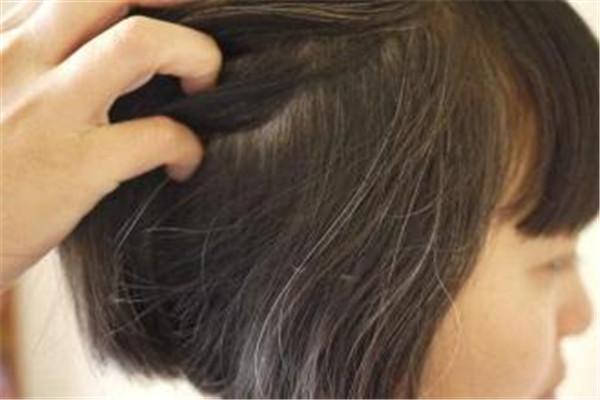 White hair at a young age?White hair grows on the forehead, temples ...