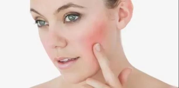 Difficulty!Dryness, peeling, tingling, itching, how difficult is it to ...