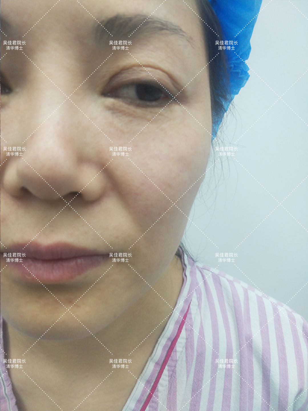 In her 30s, her face collapsed like a 50-year-old aunt. She ...