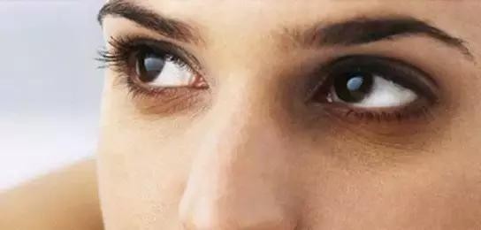 How do your "dark circles" form?3 types of dark circles, you will know ...