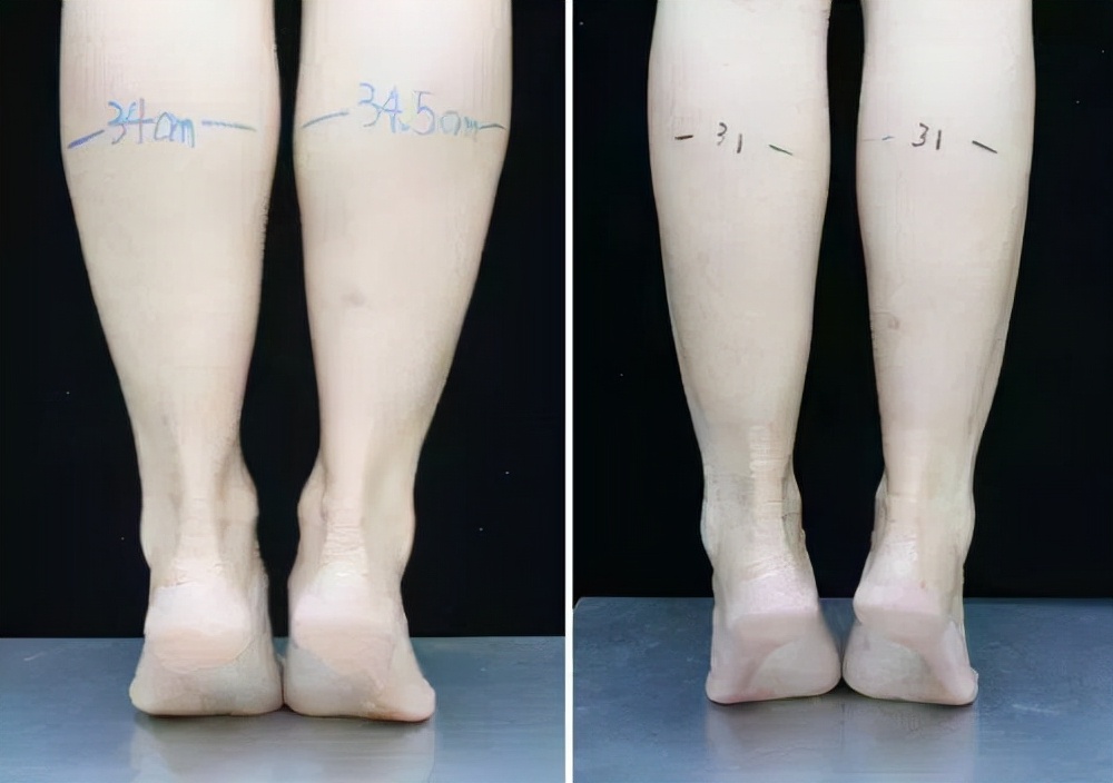 The second magic weapon for health preservation in winter-Knock the ...