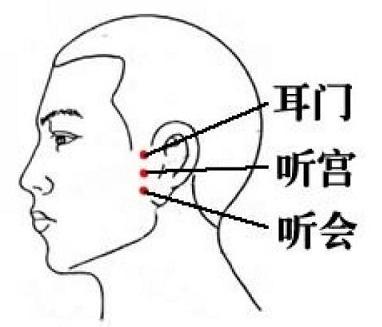 The buzzing of the ears should be treated by these several health care ...