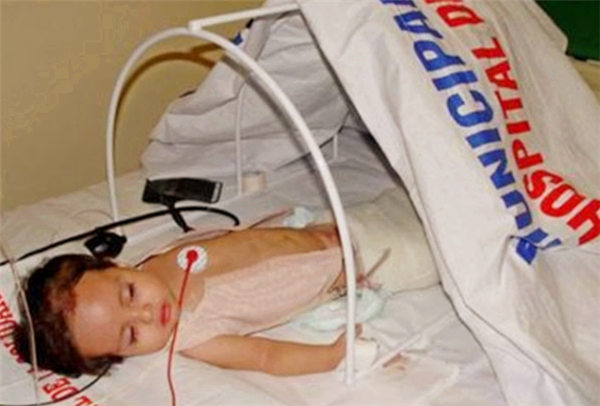 Shiloh suffering from mermaid syndrome: creating a 10-year miracle of ...