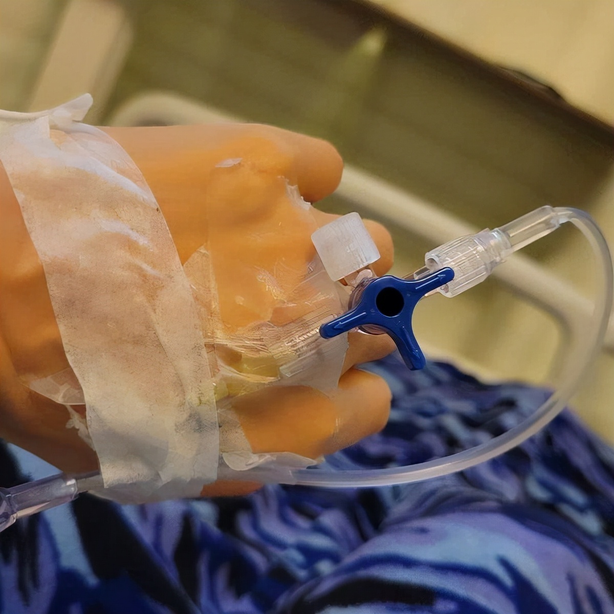 The famous TVB actress suddenly suffered from facial paralysis and ...