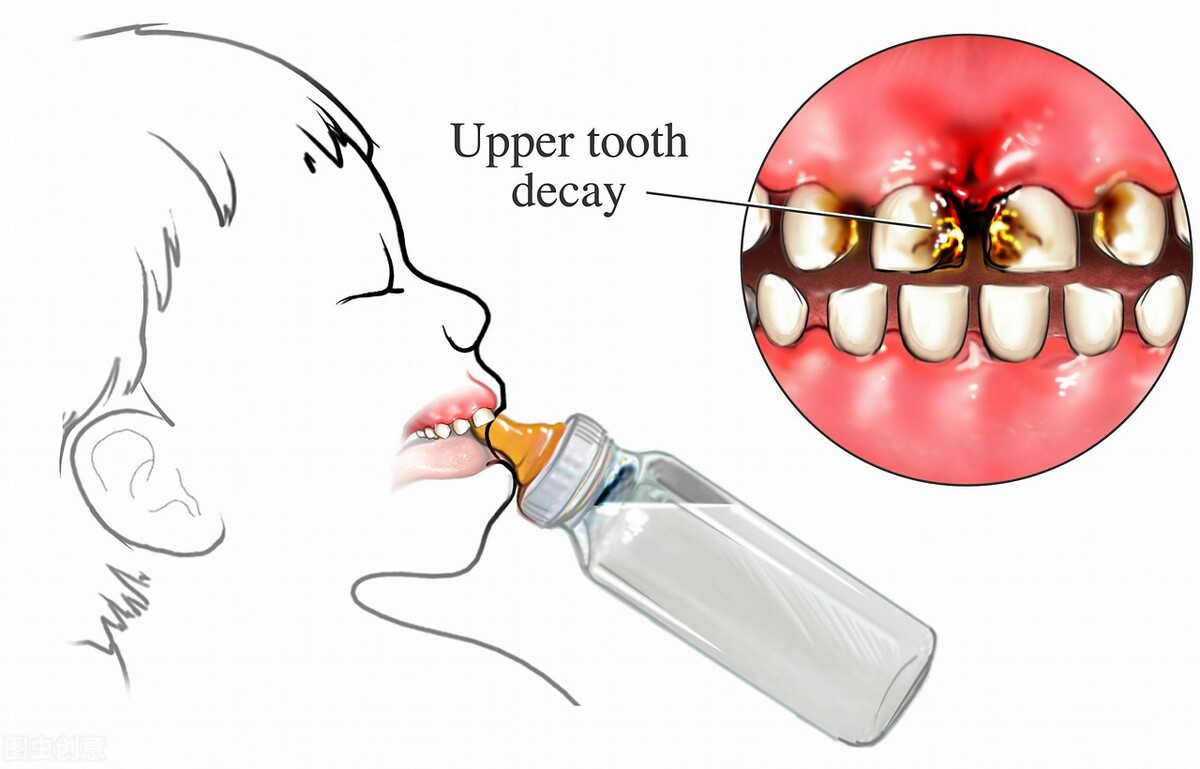 Small worm teeth are harmful, parents must understand it - iNEWS