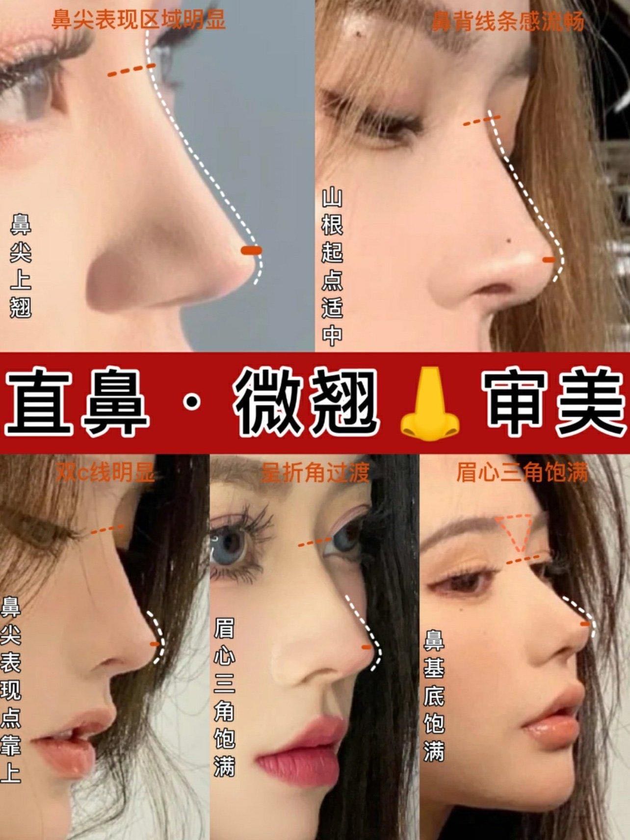 2021 Hottest Nose Type - iMedia