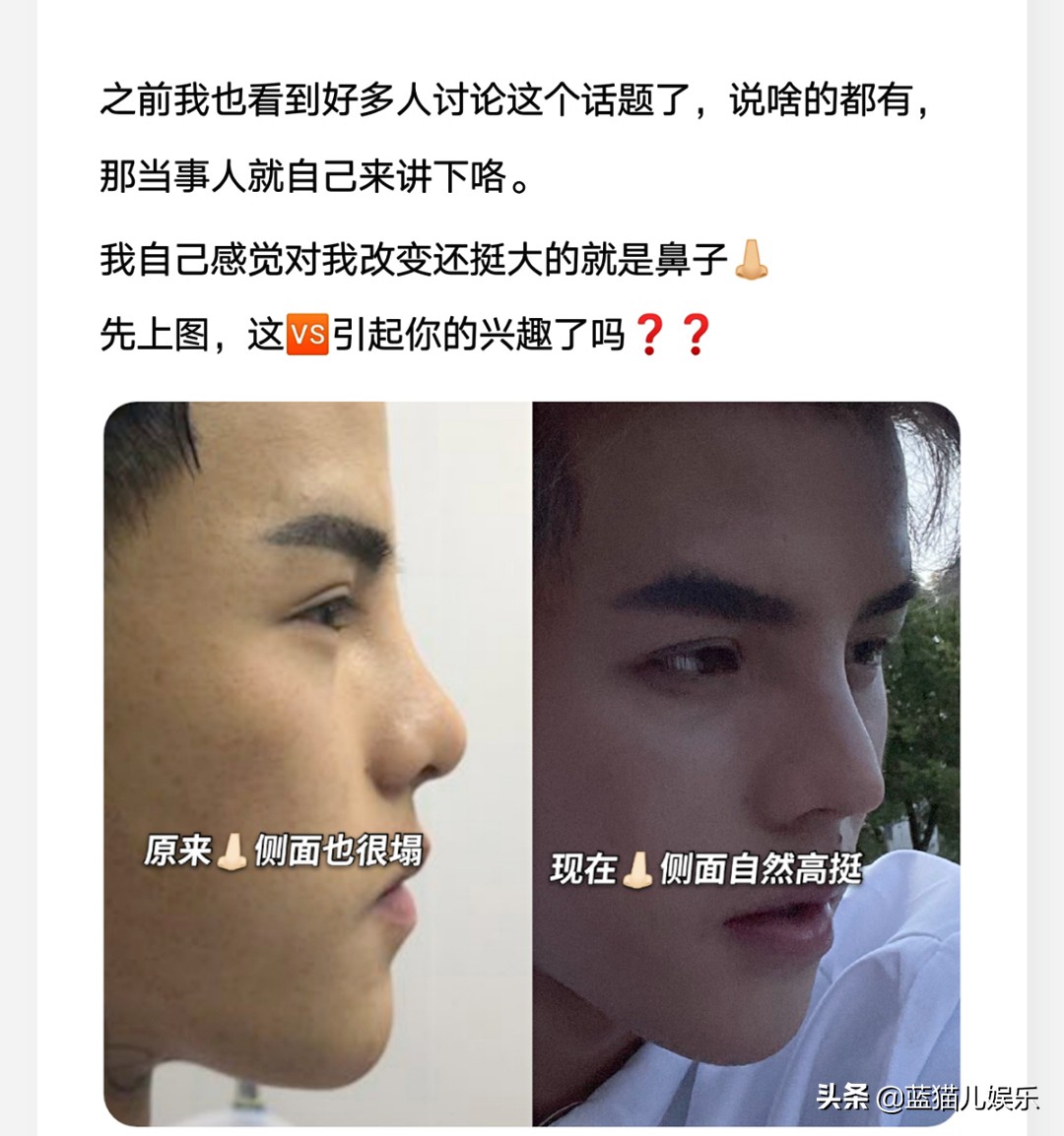 The lost Yin Shihang: The eyeballs were won by the process of cosmetic ...