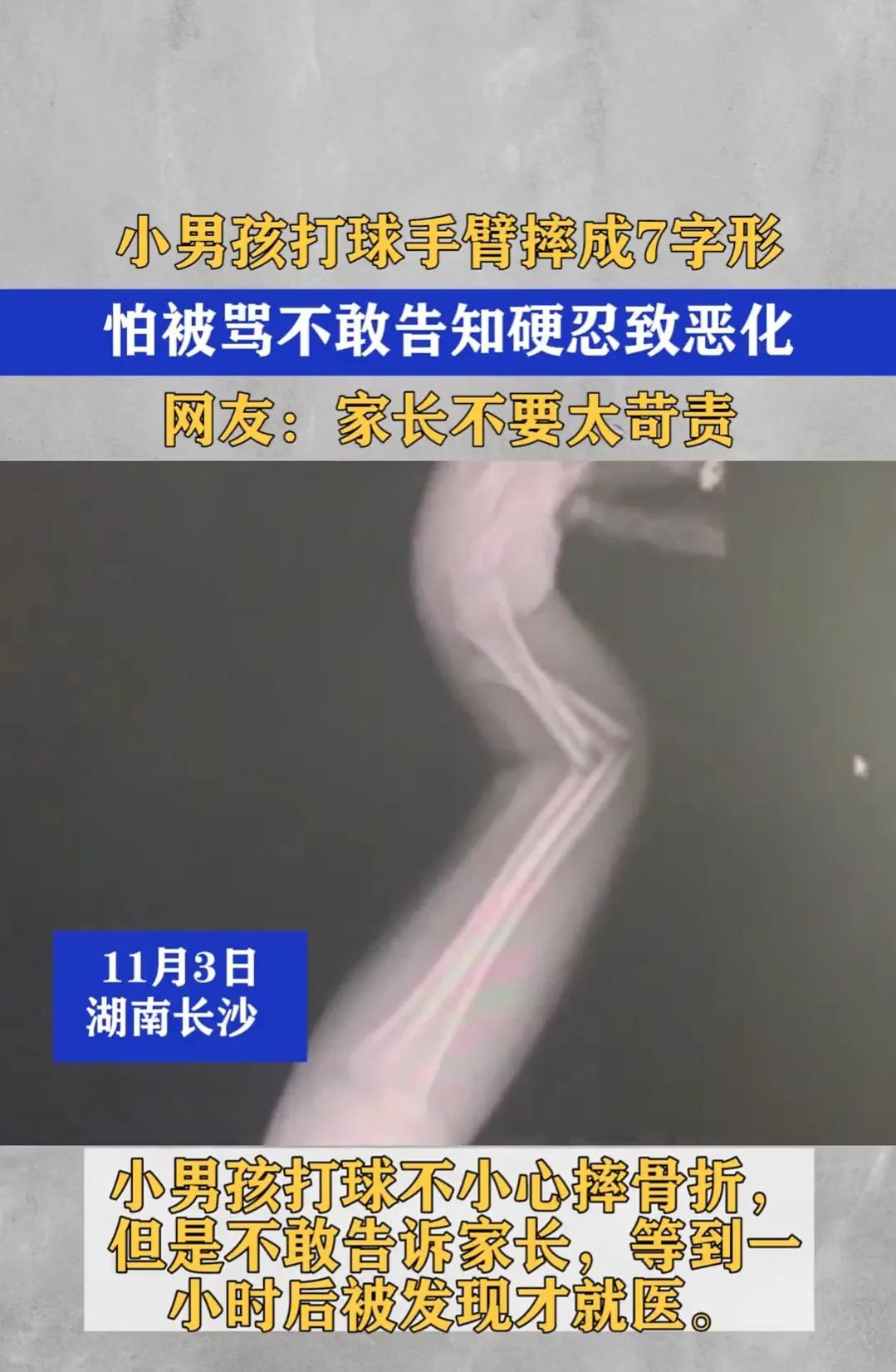 The boy's playing arm fell into a 7-shape, and he was afraid of being ...